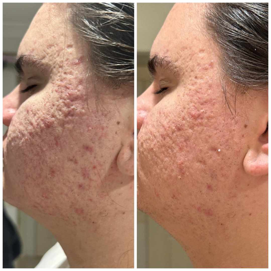 Roccoco Botanicals | Skin Solution Experts