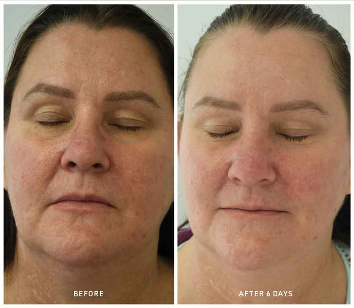 Roccoco Botanicals | Skin Solution Experts