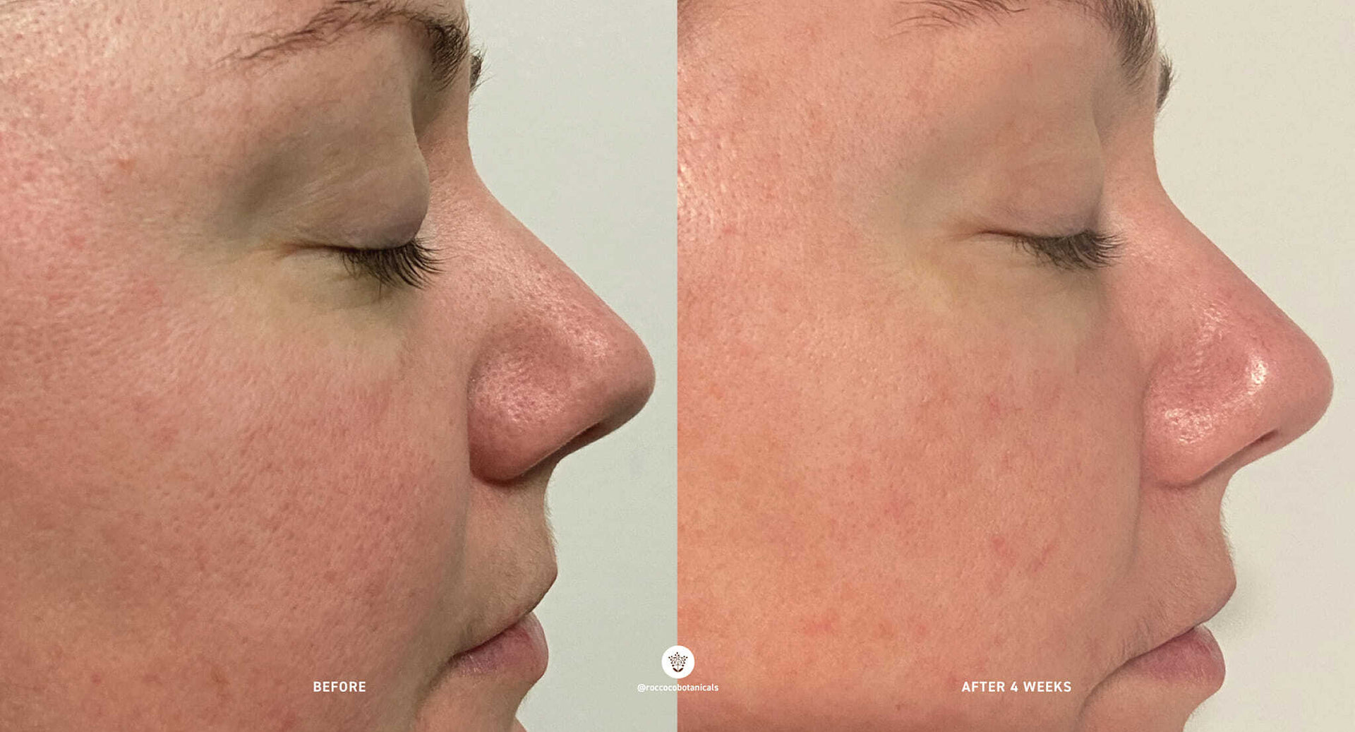 Roccoco Botanicals | Skin Solution Experts